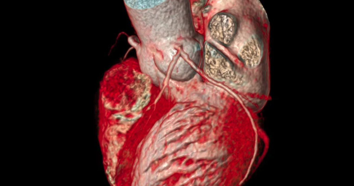 Identify characteristics which can help predict poor vascular function ...